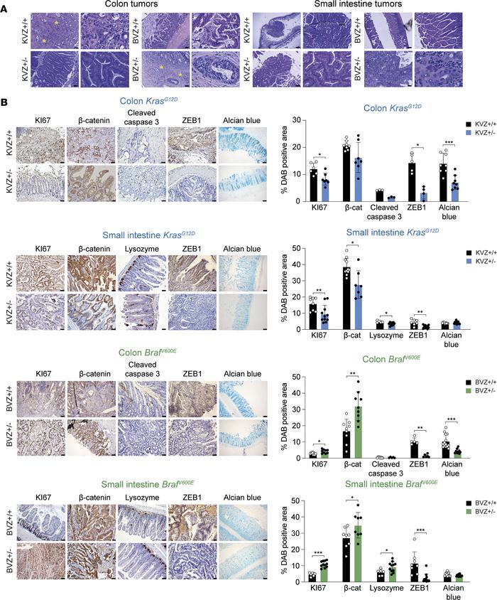 Jci Insight The Emt Factor Zeb1 Paradoxically Inhibits Emt In Braf