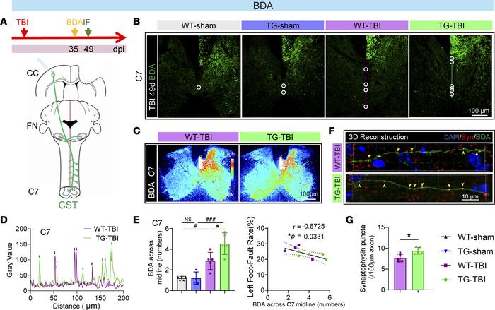 Jci Insight Hspb2 Facilitates Neural Regeneration Through Autophagy