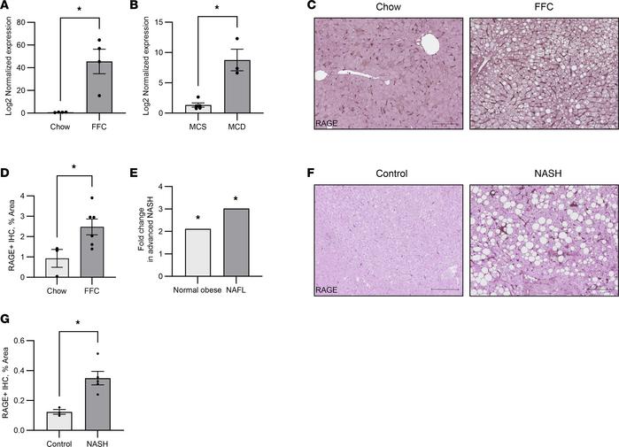 Jci Insight Macrophage Rage Activation Is Proinflammatory In Nash