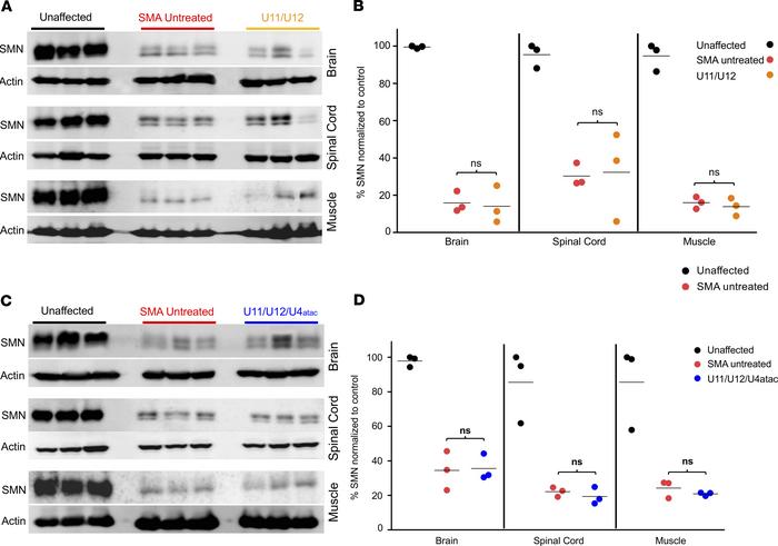 Jci Insight Minor Snrna Gene Delivery Improves The Loss Of