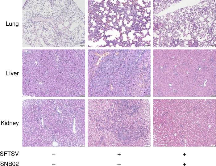 Jci Insight A Single Domain Antibody Inhibits Sftsv And Mitigates