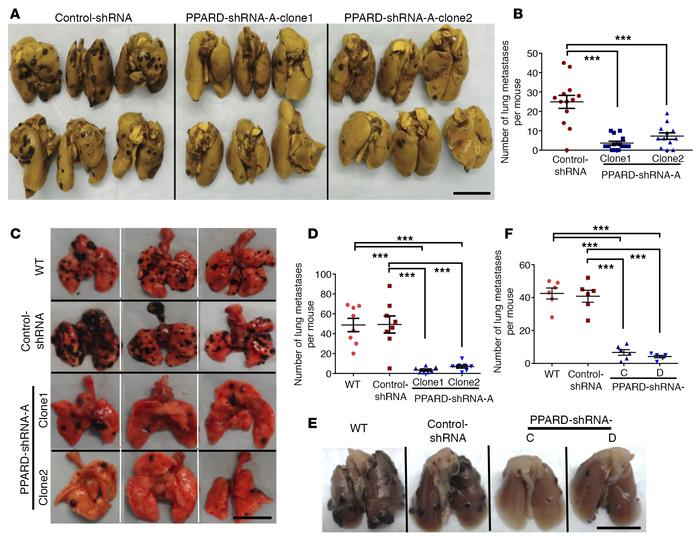 Jci Insight Metastasis Regulation By Ppard Expression In Cancer Cells