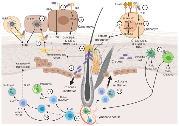 The Immunomodulatory Potential Of Phage Therapy To Treat Acne A Review