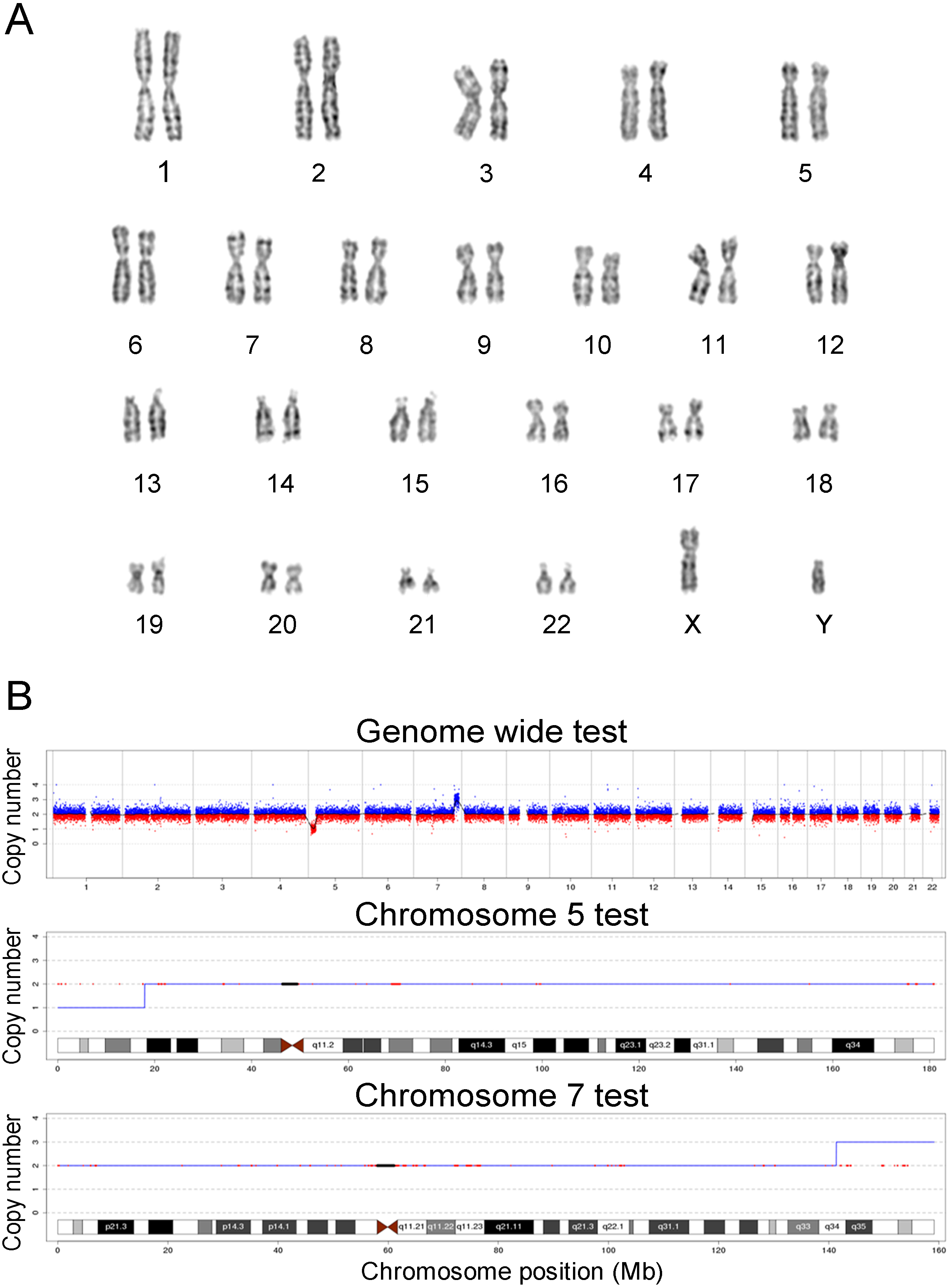 Combined Use Of Karyotyping And Copy Number Variation Sequencing