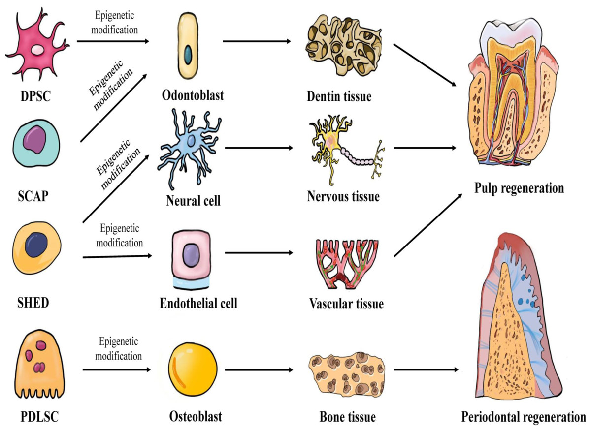 Epigenetic Regulation Of Dental Derived Stem Cells And Their