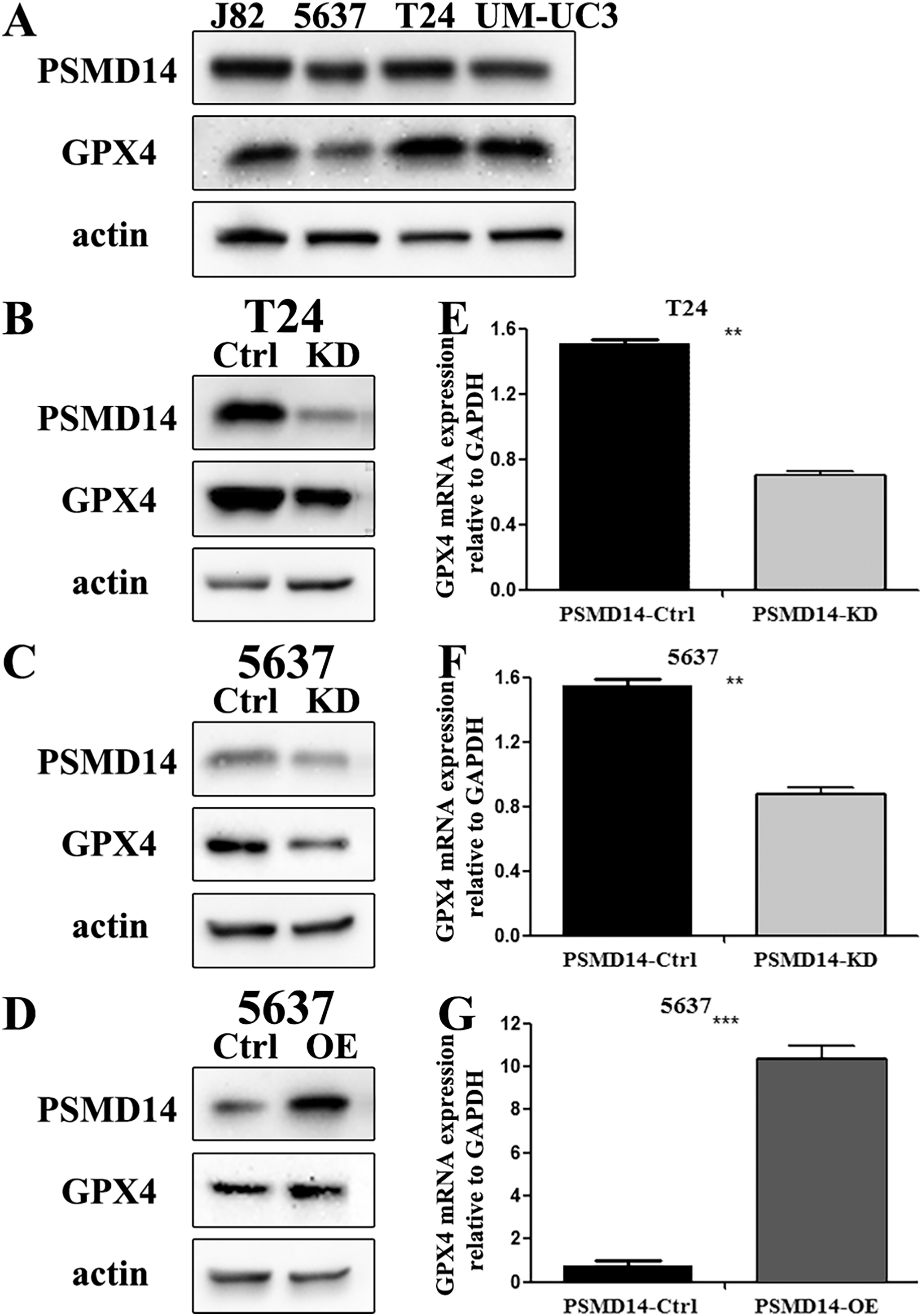 Depletion Of Psmd14 Suppresses Bladder Cancer Proliferation By