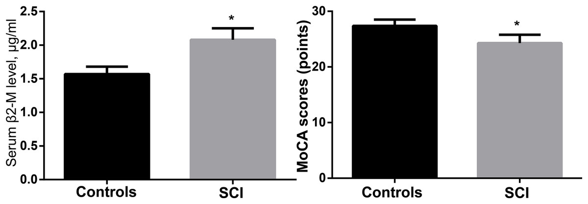 Higher Serum β2 Microglobulin Is A Predictive Biomarker For Cognitive