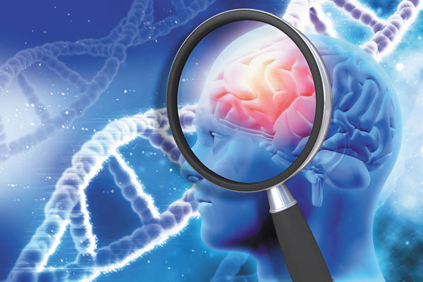 The Genetic Link Between Alzheimers And Heart Disease Harvard Health