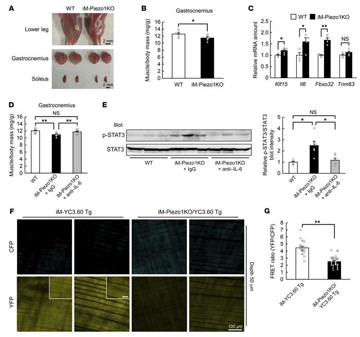 Jci A Piezo1klf15il 6 Axis Mediates Immobilization Induced Muscle