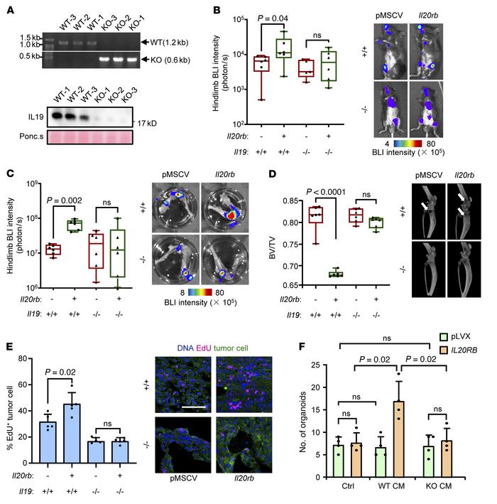 Jci Il 20rb Mediates Tumoral Response To Osteoclastic Niches And