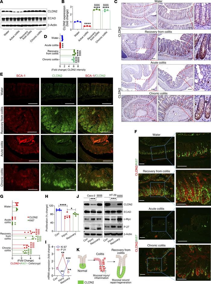 Jci Claudin 2 Protects Against Colitis Associated Cancer By Promoting