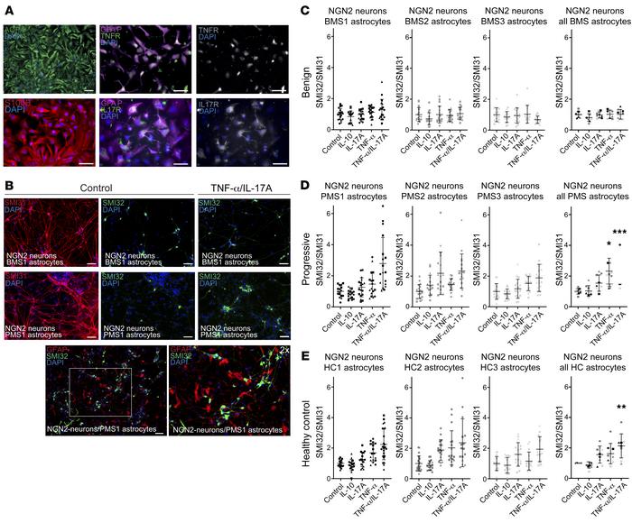 Jci Ipsc Derived Reactive Astrocytes From Patients With Multiple