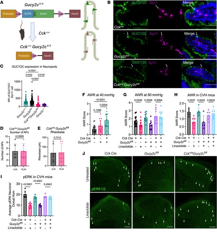 Jci Intestinal Neuropod Cell Gucy2c Regulates Visceral Pain