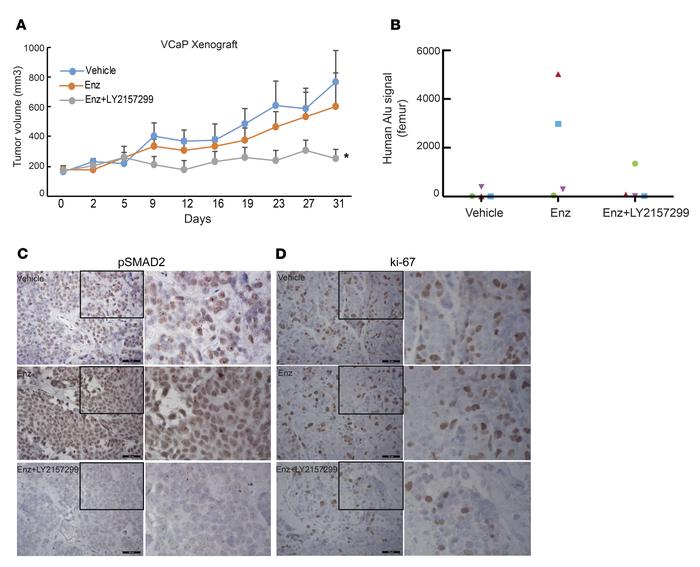 Jci Targeting Foxa1 Mediated Repression Of Tgf β Signaling Suppresses