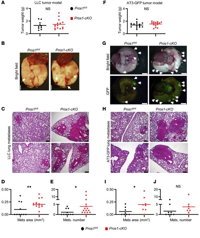 Jci Myeloid Cellderived Pros1 Inhibits Tumor Metastasis By