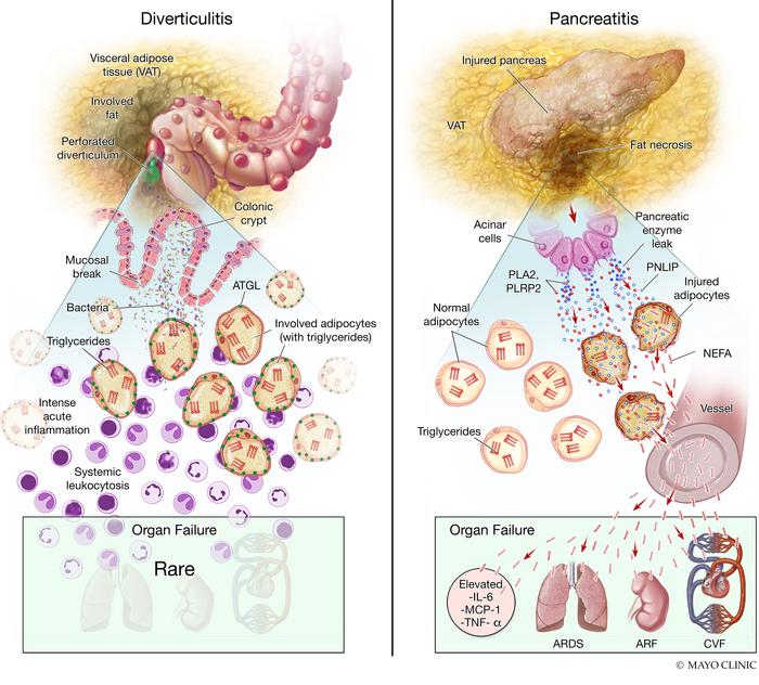 Jci Pancreatic Triglyceride Lipase Mediates Lipotoxic Systemic