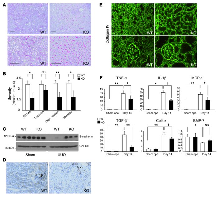 Jci Uterine Sensitization Associated Gene1 Usag 1 A Novel Bmp