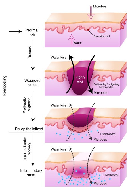 Jci Epidermal Barrier Formation And Recovery In Skin Disorders