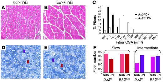 Jci Targeted Ablation Of Ikk2 Improves Skeletal Muscle Strength