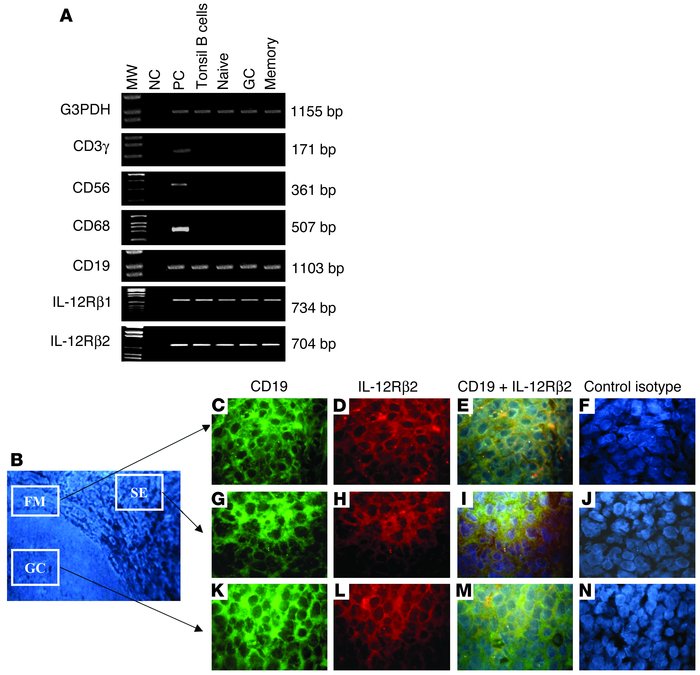 Jci The Il 12rβ2 Gene Functions As A Tumor Suppressor In Human B Cell