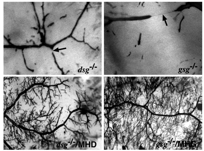 Jci Smooth Muscle Cellextrinsic Vascular Spasm Arises From