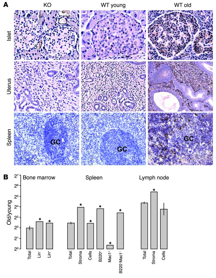 Jci Ink4aarf Expression Is A Biomarker Of Aging