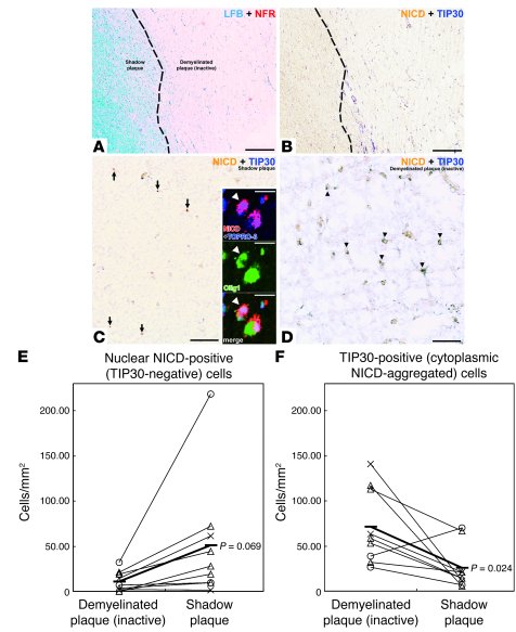 Jci Abnormal Expression Of Tip30 And Arrested Nucleocytoplasmic