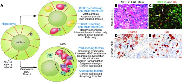 Jci Toward Unraveling The Complexity Of Simple Epithelial Keratins In