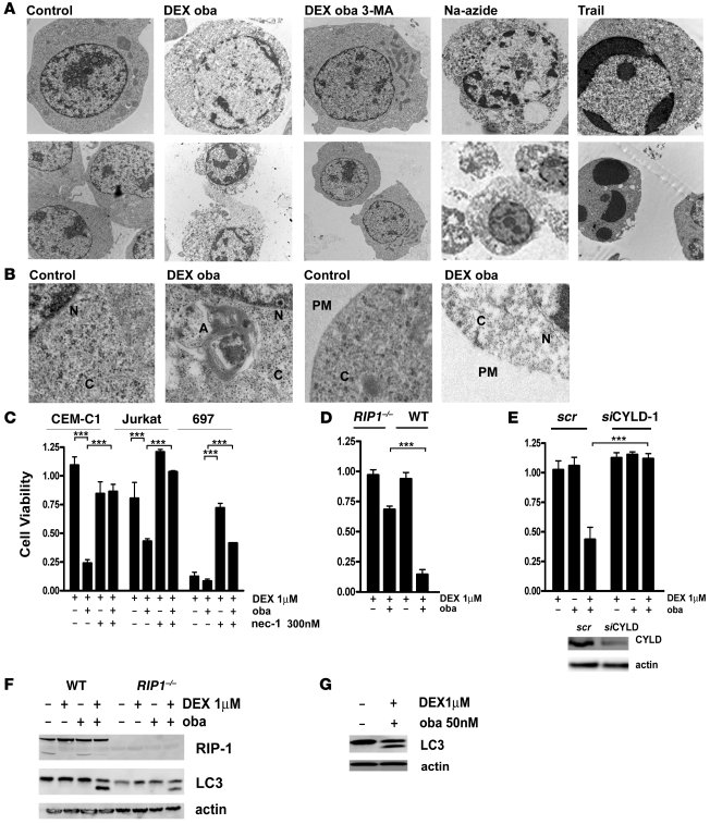 Jci Induction Of Autophagy Dependent Necroptosis Is Required For