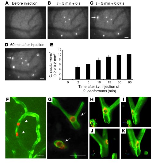 Jci Real Time Imaging Of Trapping And Urease Dependent Transmigration