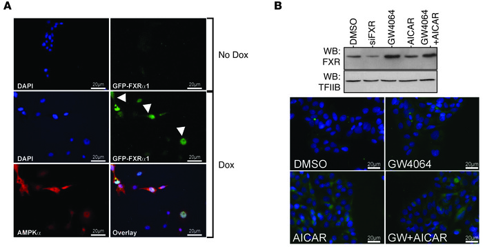 Jci Metformin Interferes With Bile Acid Homeostasis Through Ampk Fxr