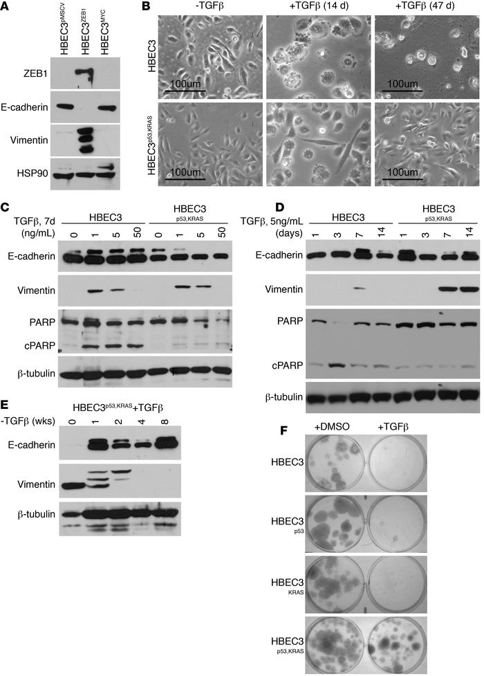 Jci Zeb1 Drives Epithelial To Mesenchymal Transition In Lung Cancer