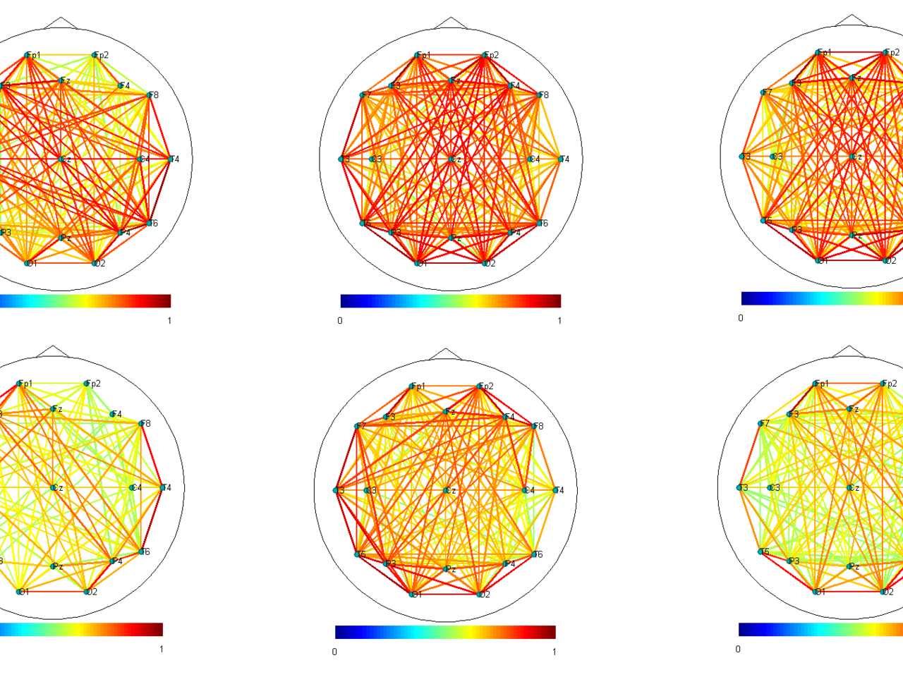 Brain Connectivity Analysis With Classification Intel Devmesh