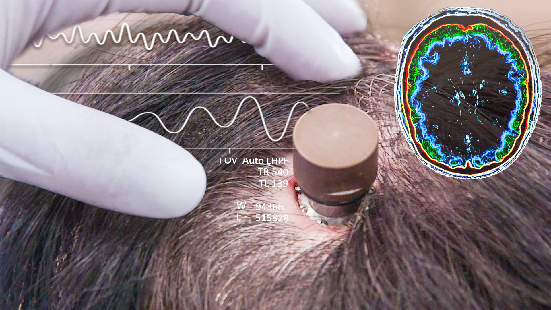 Watch The Science Behind Elon Musks Neuralink Brain Chip Currents