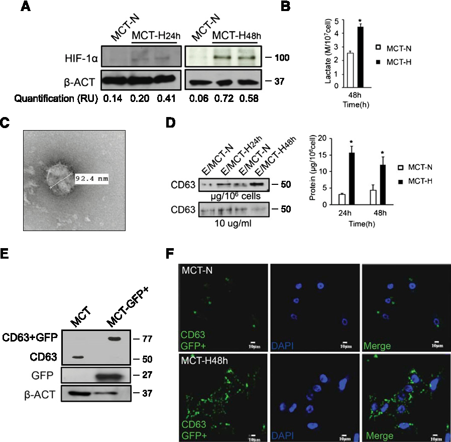 Figure 1 From Tgf β1 Containing Exosomes From Injured Epithelial Cells