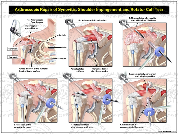 Custom Medical Illustration Anatomical Justice