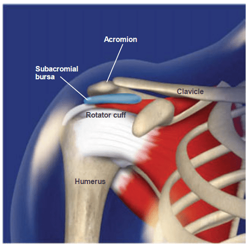 Shoulder Impingement Syndrome Symptoms And Treatments