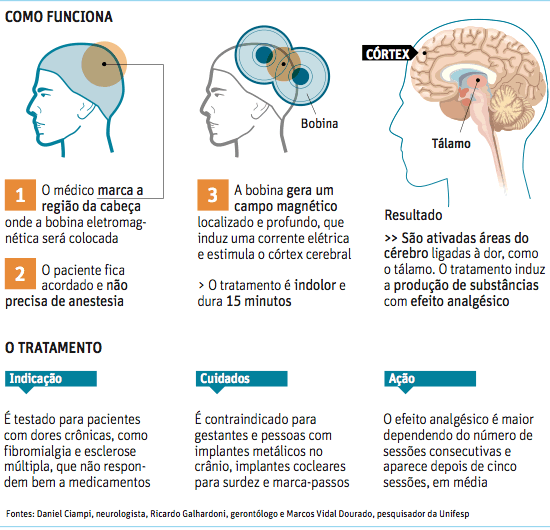 No Mundo Da Neuroestimulação A Estimulação Magnética Transcraniana