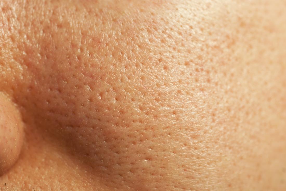 How To Get Rid Of Large Pores The Top 8 Ways