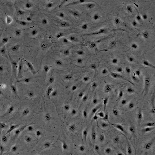 Human Pulmonary Artery Endothelial Cells Cells Online