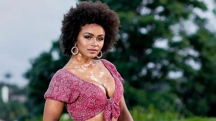 Tem Cura Natália Deotado Participante Do Big Brother Brasil 22 Tem