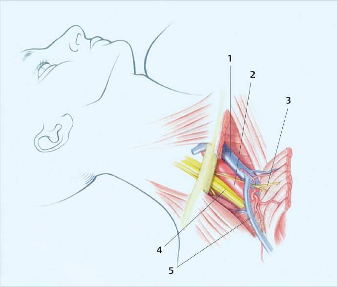 4 Supraclavicular And Infraclavicular Techniques Of Brachial Plexus