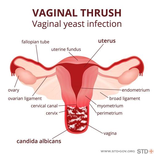 Yeast Infections Natural Remedies Angies Diary