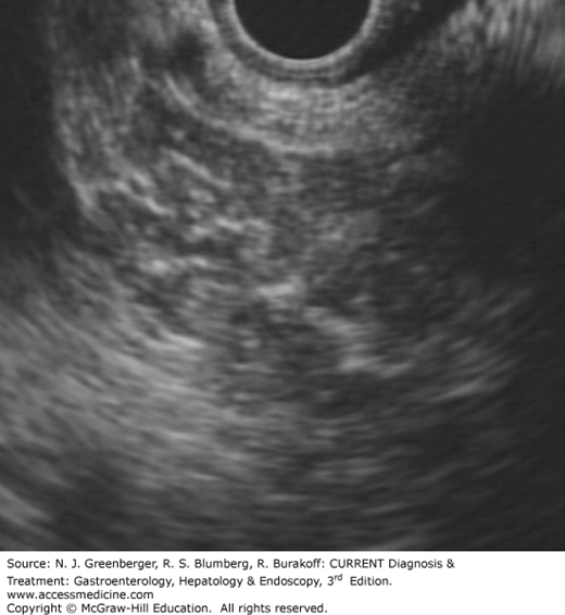 Endoscopic Ultrasound Abdominal Key