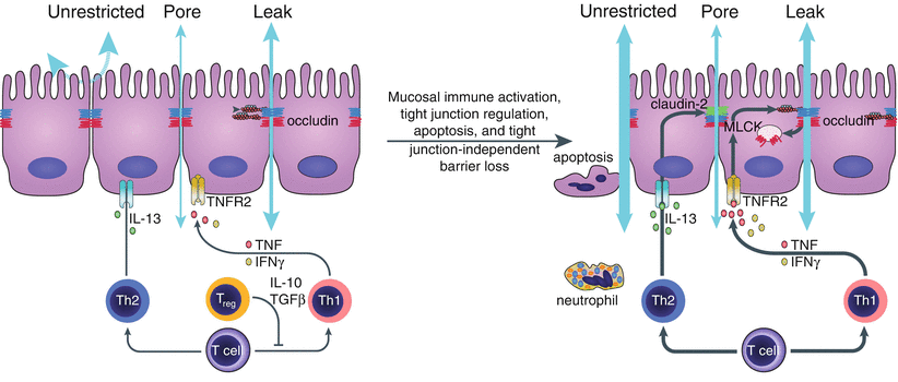 Understanding The Epithelial Barrier In Ibd Abdominal Key