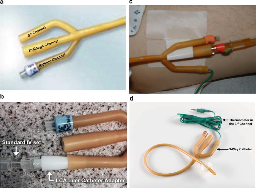 Indwelling Transurethral And Suprapubic Catheters Abdominal Key