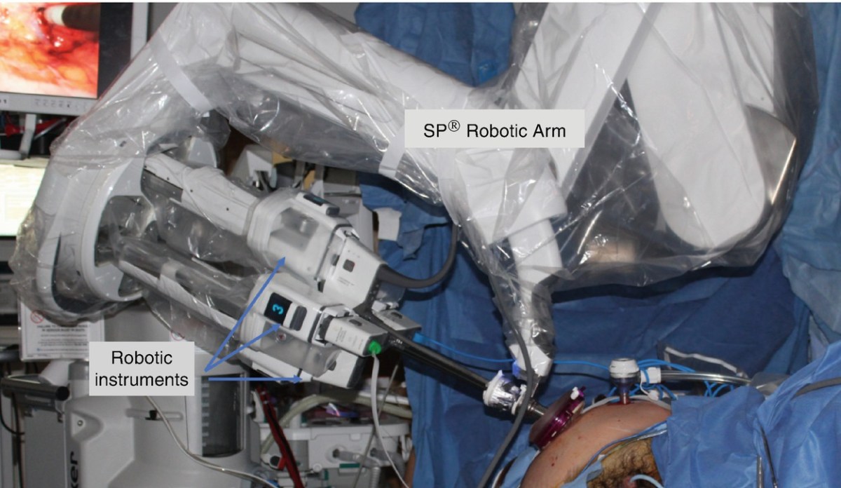 And Robot Assisted Laparoendoscopic Single Site Urologic Surgery