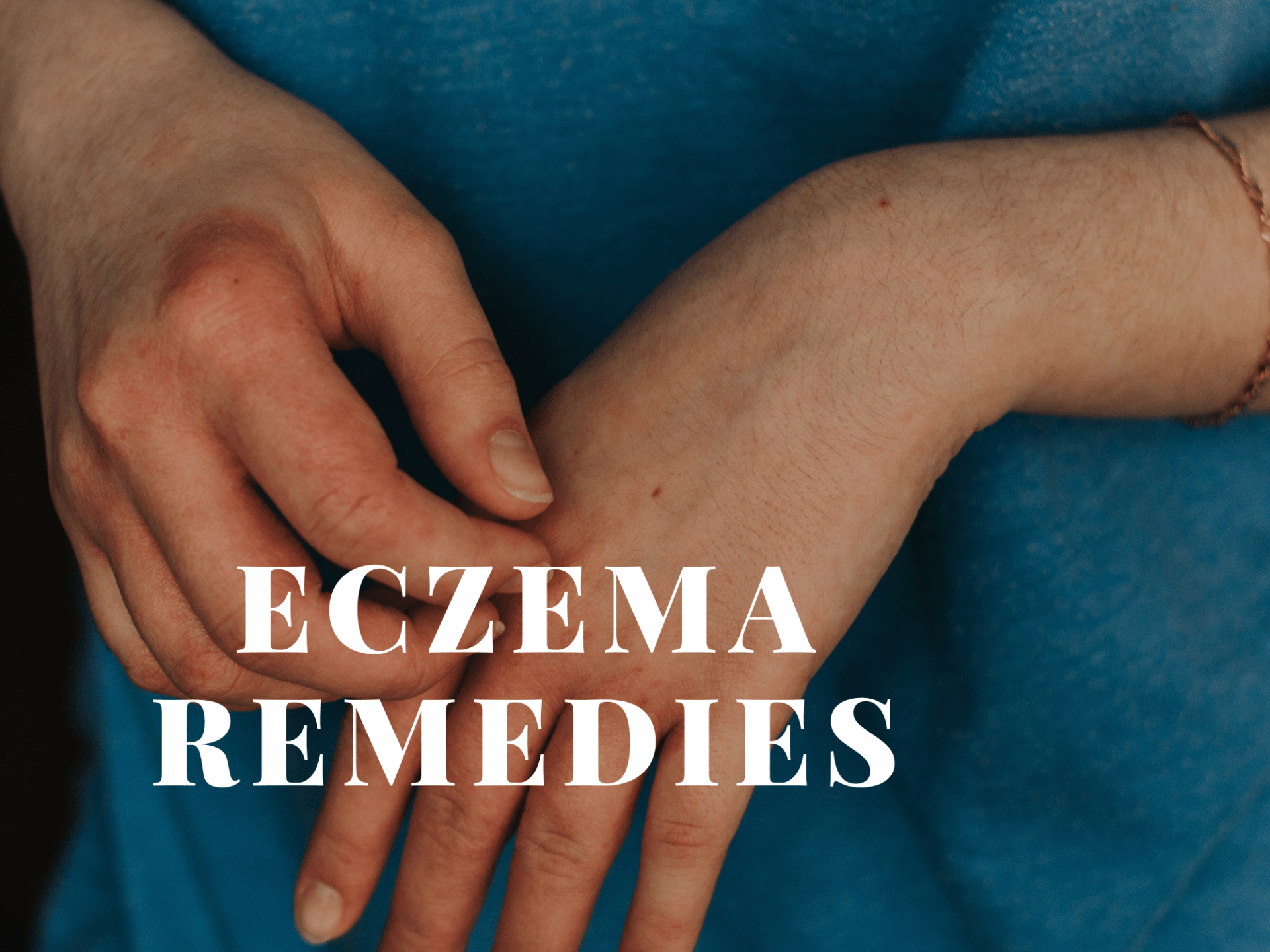 How To Prevent An Eczema Flare Up Alex Hui