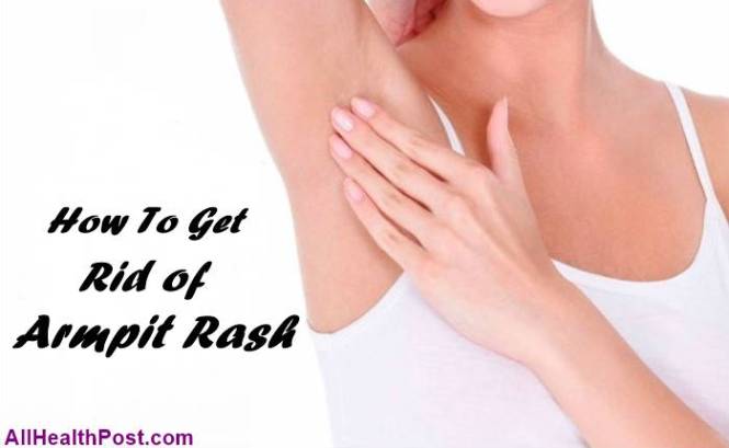 Home Remedy For Itchy Underarm Rash Bruin Blog