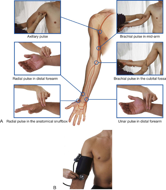 Upper Limb Basicmedical Key